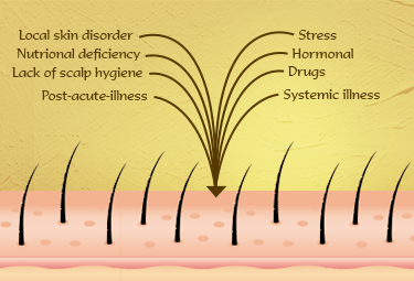 Hair fall : reasons and measures to control | Kesh King